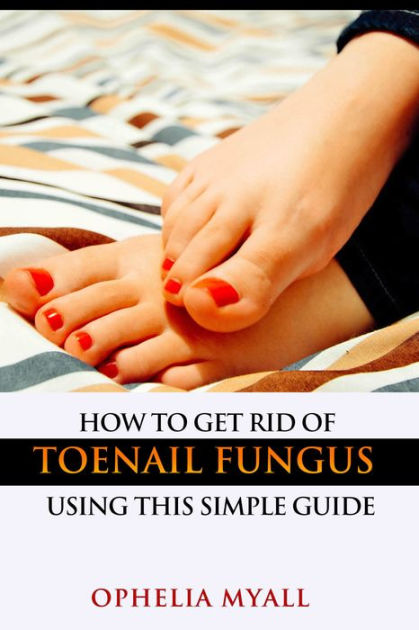 How To Get Rid Of Toenail Fungus Using This Simple Guide By Ophelia