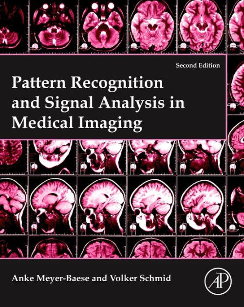 Pattern Recognition and Signal Analysis in Medical Imaging by Anke Meyer-Baese, Volker J. Schmid ...