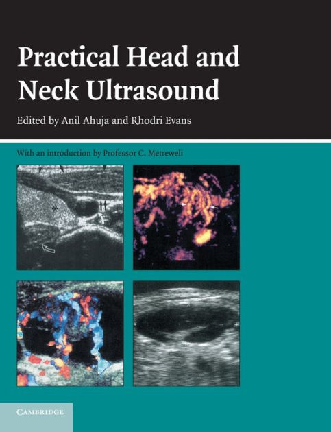 Practical Head And Neck Ultrasound By Anil T Ahuja 9780521683210