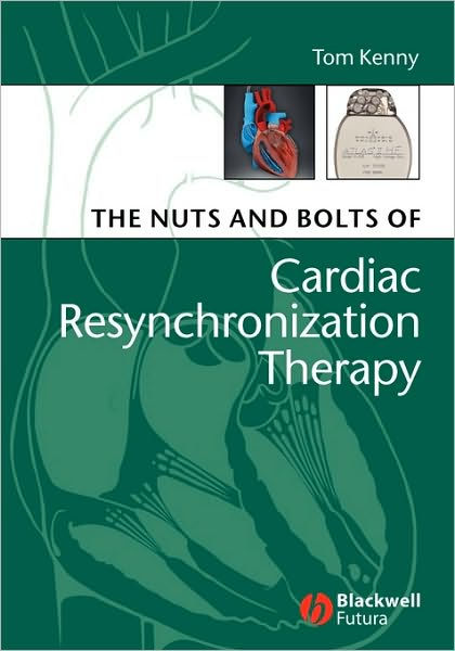 The Nuts and Bolts of Cardiac Resynchronization Therapy by Tom Kenny ...