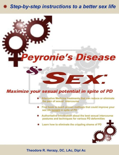 Peyronies Disease And Sex Maximize Your Sexual Potential In Spite Of