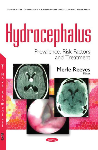 Hydrocephalus Prevalence Risk Factors And Treatment By Merle Reeves