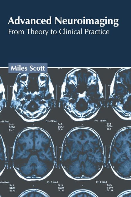 Advanced Neuroimaging: From Theory to Clinical Practice by Miles Scott, Hardcover | Barnes & Noble®