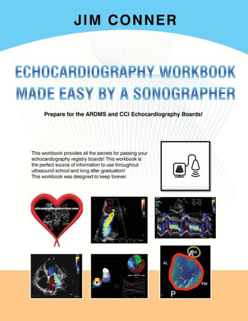 Echocardiography Workbook: Echocardiography Made Easy By A Sonographer by Jim Conner, Paperback ...