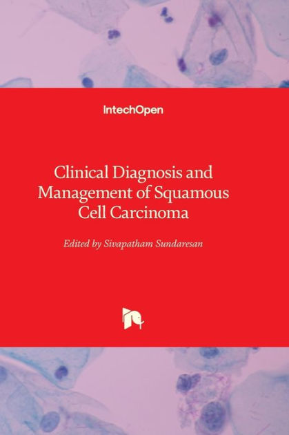 Clinical Diagnosis and Management of Squamous Cell Carcinoma by Sivapatham Sundaresan, Hardcover ...