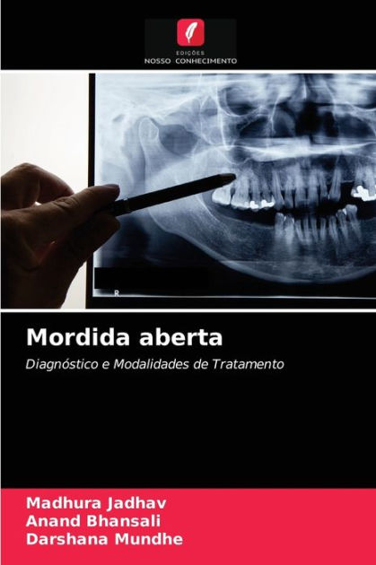 Mordida aberta by Madhura Jadhav, Anand Bhansali, Darshana Mundhe, Paperback | Barnes & Noble®