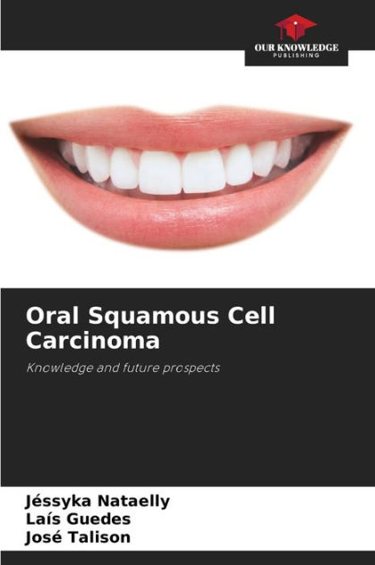 Oral Squamous Cell Carcinoma By Jéssyka Nataelly Laís Guedes José