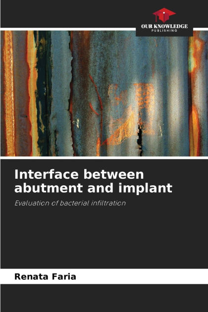 Interface between abutment and implant by Renata Faria, Paperback | Barnes & Noble®