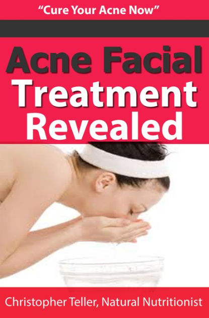 Acne Facial Treatment Revealed by Christopher Teller | eBook | Barnes ...