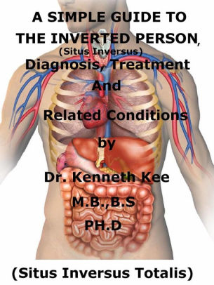 A Simple Guide To The Inverted Person, (Situs Inversus) Diagnosis ...