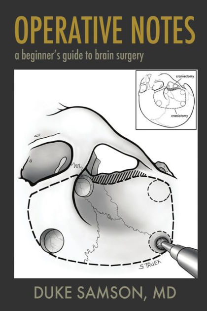 Operative Notes: a beginner's guide to brain surgery by Duke Samson, MD ...