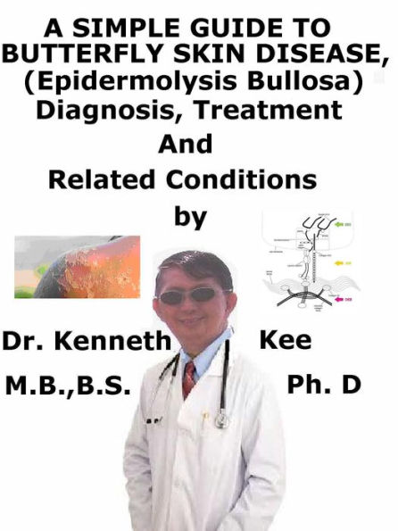 A Simple Guide to Butterfly Skin Disease (Epidermolysis Bullosa ...