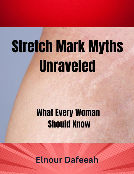 Stretch Marks Unraveled: What Every Woman Should Know by Elnour Dafeeah | eBook | Barnes & Noble®