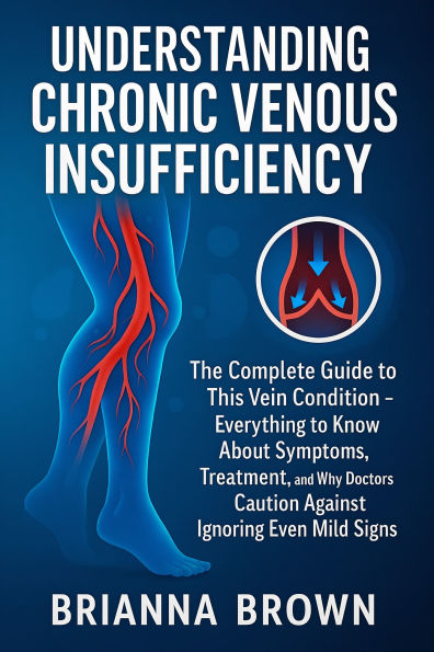 Understanding Chronic Venous Insufficiency: The Complete Guide to This ...