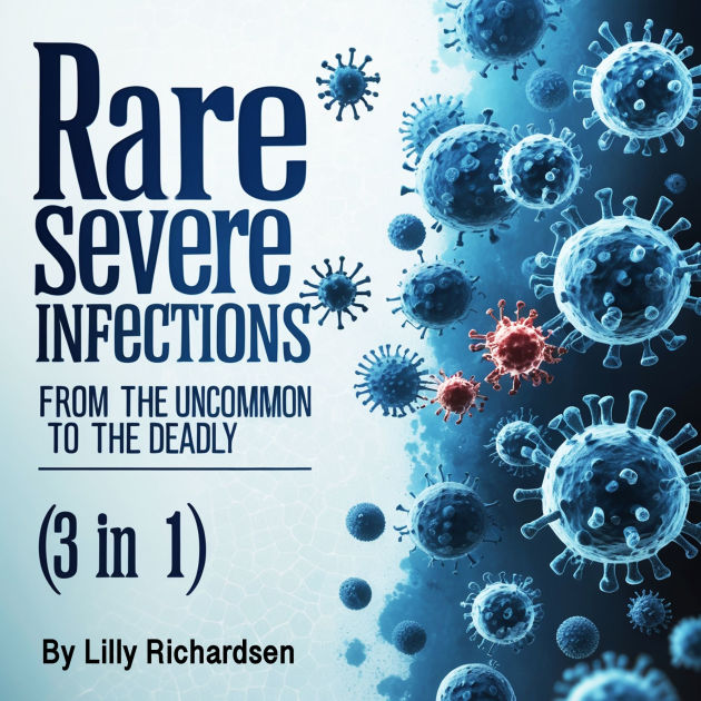 Rare & Severe Infections: From the Uncommon to the Deadly (3 in 1) by ...