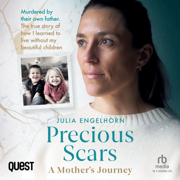 Precious Scars by Julia Engelhorn, Antonia Beamish | 2940194002047 ...