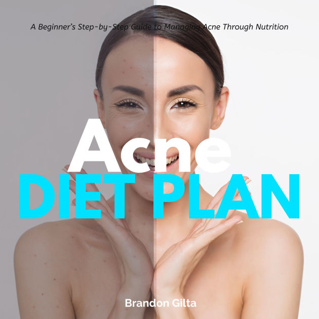 Acne Diet Plan: A Beginner's Step-by-Step Guide to Managing Acne ...