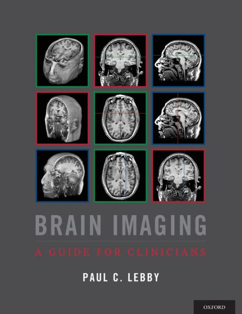 Brain Imaging: A Guide for Clinicians by Paul C. Lebby | 9780190239060 ...