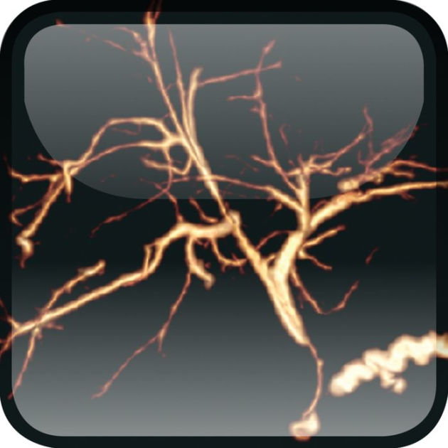 Mayo Clinic Body MRI Case Review by Christine U.C. Lee, James Glockner ...