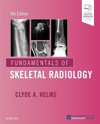 Fundamentals of Skeletal Radiology / Edition 5 by Clyde A. Helms MD ...