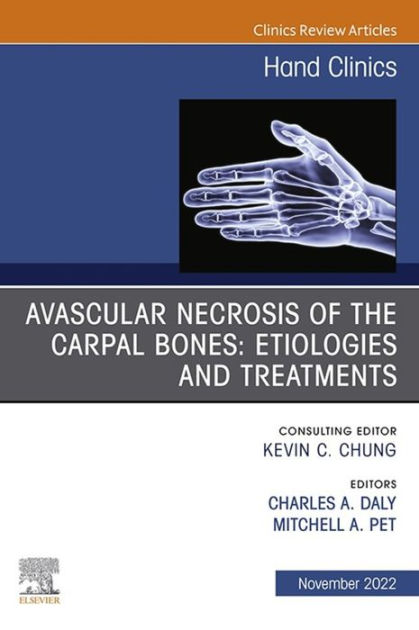 Avascular Necrosis of the Carpal Bones: Etiologies and Treatments, An ...