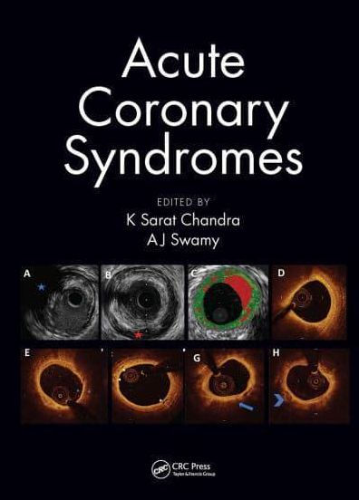 Acute Coronary Syndromes by K Sarat Chandra, Paperback | Barnes & Noble®