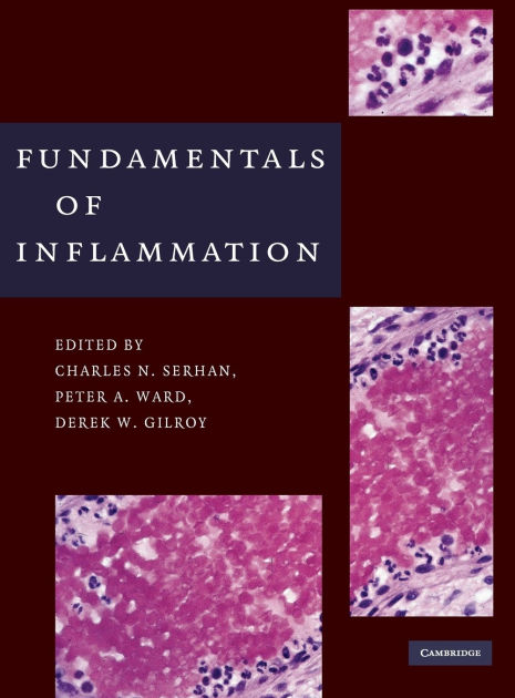 Fundamentals of Inflammation by Charles N. Serhan PhD | 9780521887298 ...