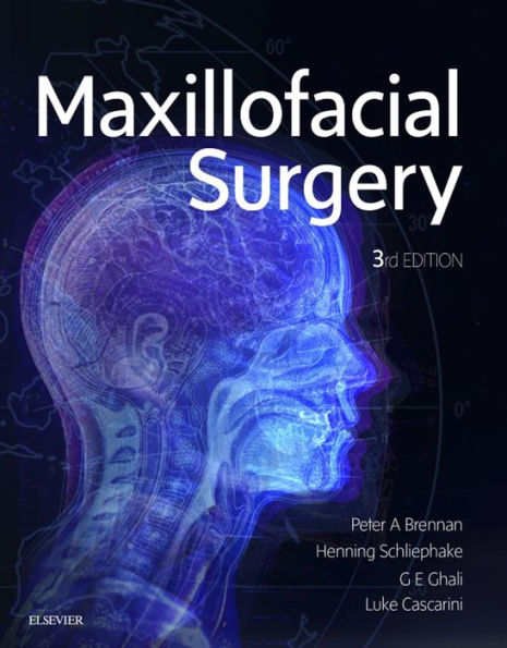 Maxillofacial Surgery: 2-Volume Set by Peter A. Brennan, Henning Prof Dr Schliephake, MD Ghali ...