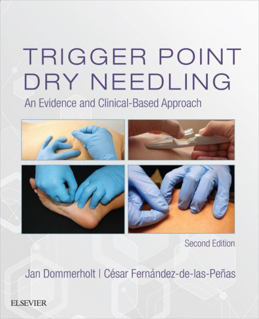 Trigger Point Dry Needling E-Book: Trigger Point Dry Needling E-Book by ...