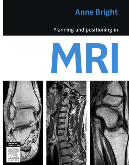 Planning and Positioning in MRI - E-Book by Anne Bright | eBook ...