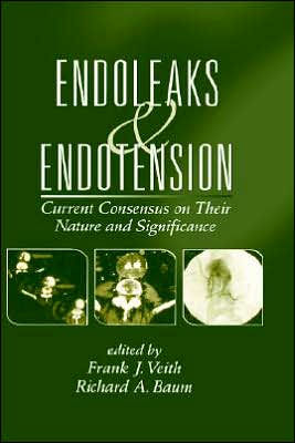 Endoleaks and Endotension: Current Consensus on Their Nature and ...