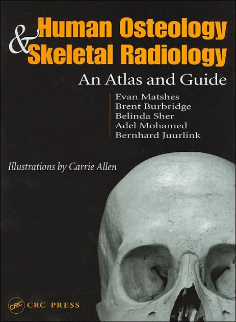 Human Osteology and Skeletal Radiology: An Atlas and Guide by Evan W ...