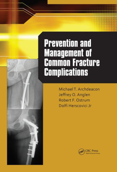 Prevention and Management of Common Fracture Complications by Michael ...