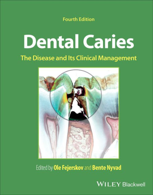 Dental Caries: The Disease and its Clinical Management by Ole Fejerskov ...