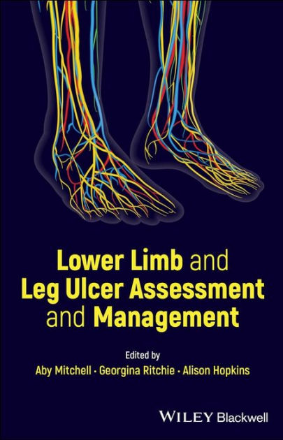 Lower Limb and Leg Ulcer Assessment and Management by Aby Mitchell ...