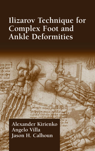 Ilizarov Technique for Complex Foot and Ankle Deformities by Alexander ...