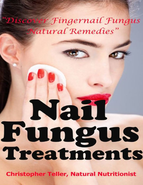 Nail Fungus Treatments: Discover Fingernail Fungus Natural Remedies by ...