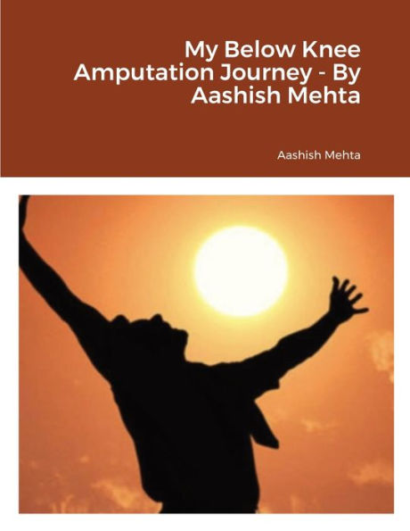 My Below Knee Amputation Journey - By Aashish Mehta by Aashish Mehta ...