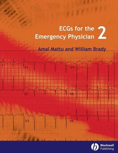 ECGs for the Emergency Physician 2 / Edition 1 by Amal Mattu, William J ...