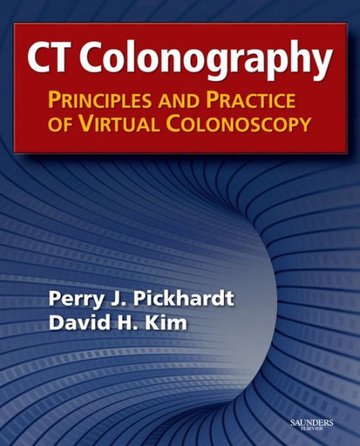 CT Colonography: Principles and Practice of Virtual Colonoscopy by ...