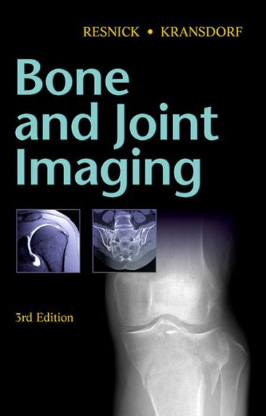 Bone and Joint Imaging by Donald L. Resnick MD, Mark J. Kransdorf MD | eBook | Barnes & Noble®