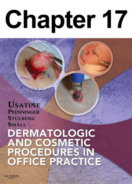 Incision and Drainage: Chapter 17 of Dermatologic and Cosmetic ...