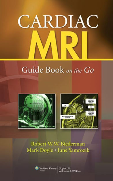 Cardiac MRI: Guide Book on the Go by Robert W. Biederman, Mark Doyle ...