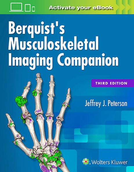 Berquist's Musculoskeletal Imaging Companion / Edition 3 by Jeffrey J ...