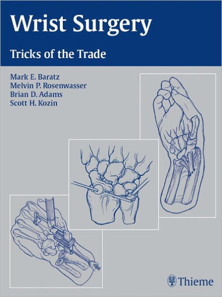 Wrist Surgery: Tricks of the Trade by Mark E. Baratz, Melvin P ...