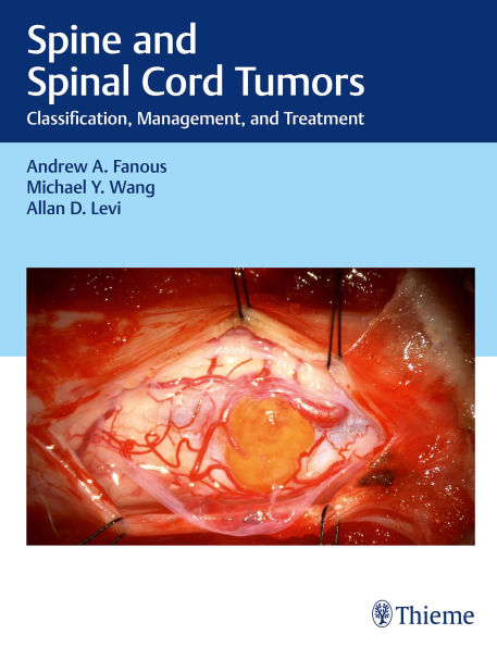 Spine and Spinal Cord Tumors: Classification, Management, and Treatment ...
