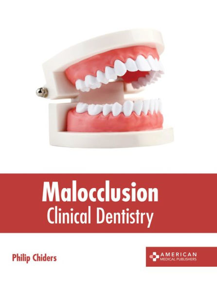 Malocclusion: Clinical Dentistry by Philip Chiders, Hardcover | Barnes ...