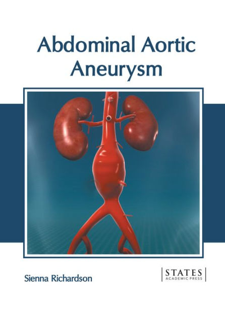 Abdominal Aortic Aneurysm by Sienna Richardson, Hardcover | Barnes & Noble®
