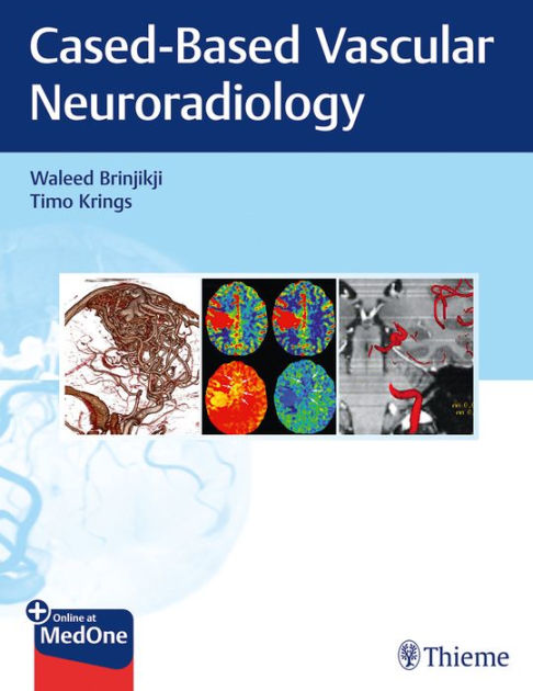 Imaging in Neurovascular Disease: A Case-Based Approach by Waleed ...