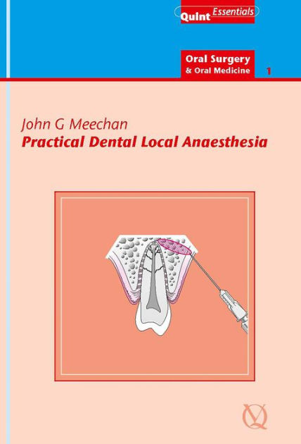 Practical Dental Local Anaesthesia by John G. Meechan | eBook | Barnes ...